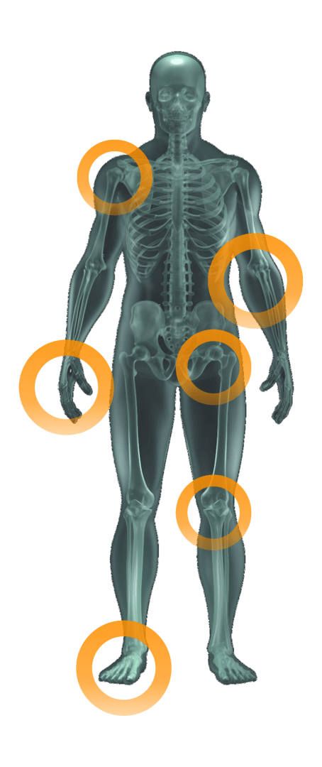 Traumatologia - Massmedica S.A.